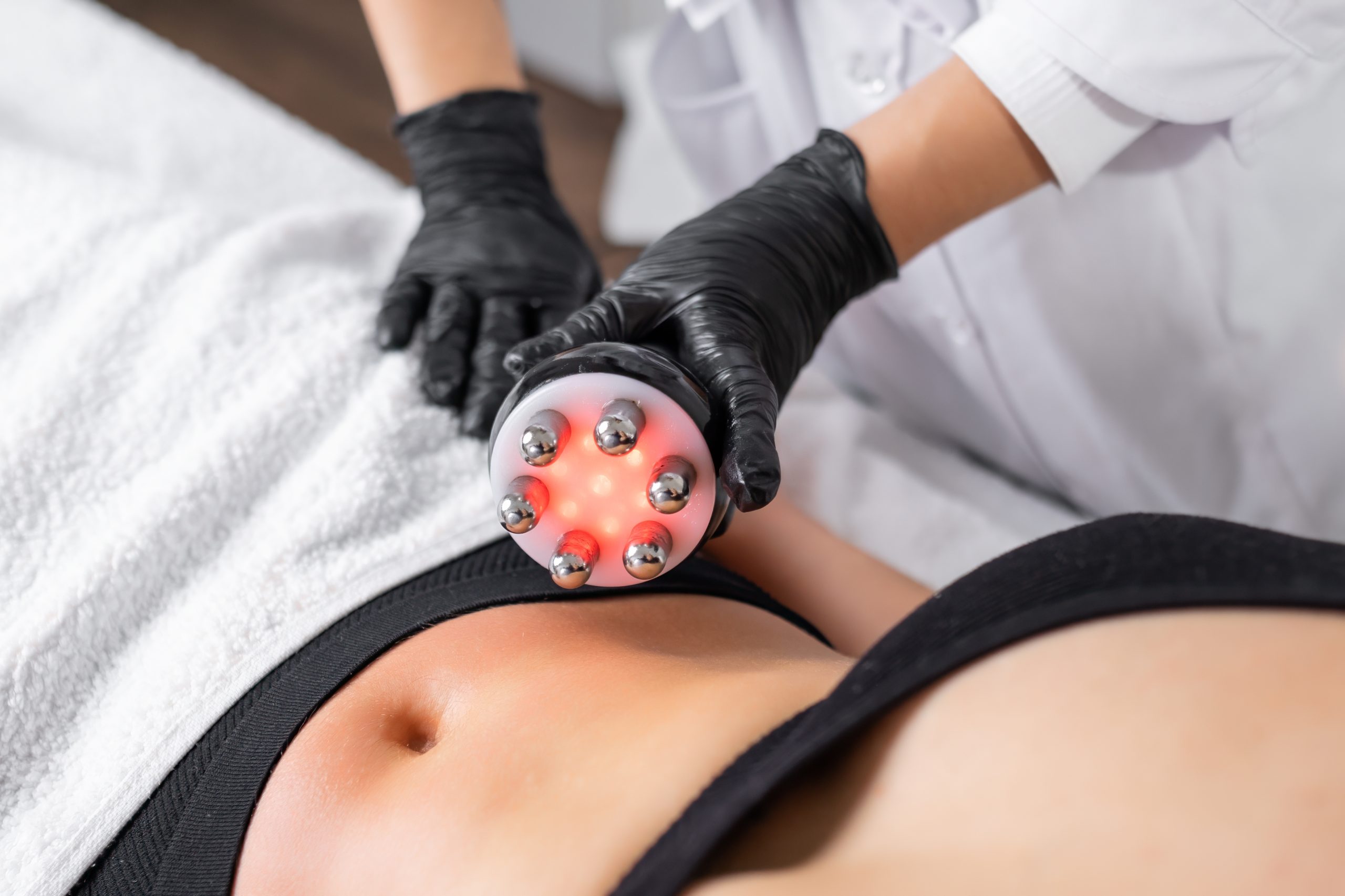 Belly Skin Reduction in Scottsdale, AZ | Beautify Spa